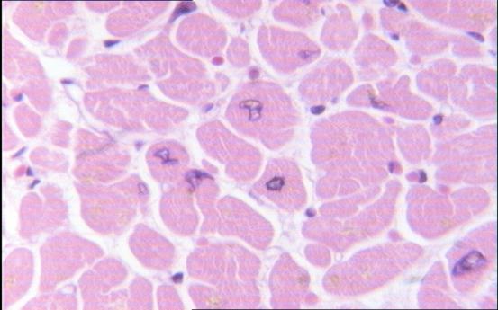 HISTOLOGIA: tejido cardiaco HISTOLOGIA: tejido cardiaco